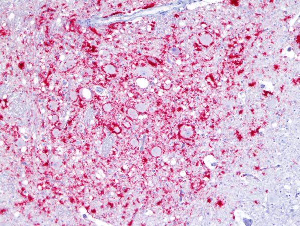 Louisiana Animal Disease Diagnostic Lab working with LDWF has detected ...